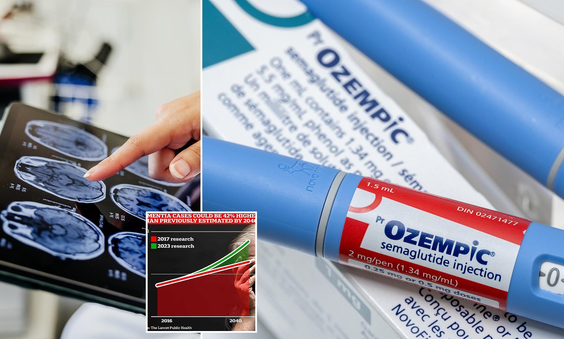 Ozempic can slash risk of Alzheimer's, study finds