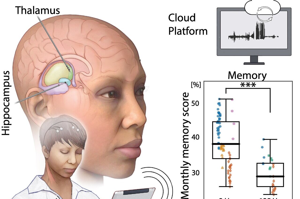 Tailored brain stimulation through implanted device offers hope for ...