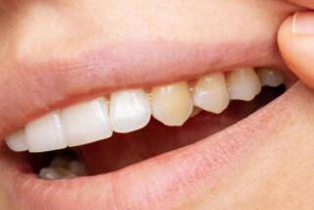 Odontóloga enumera los nutrientes que hay que consumir para mantener el ...