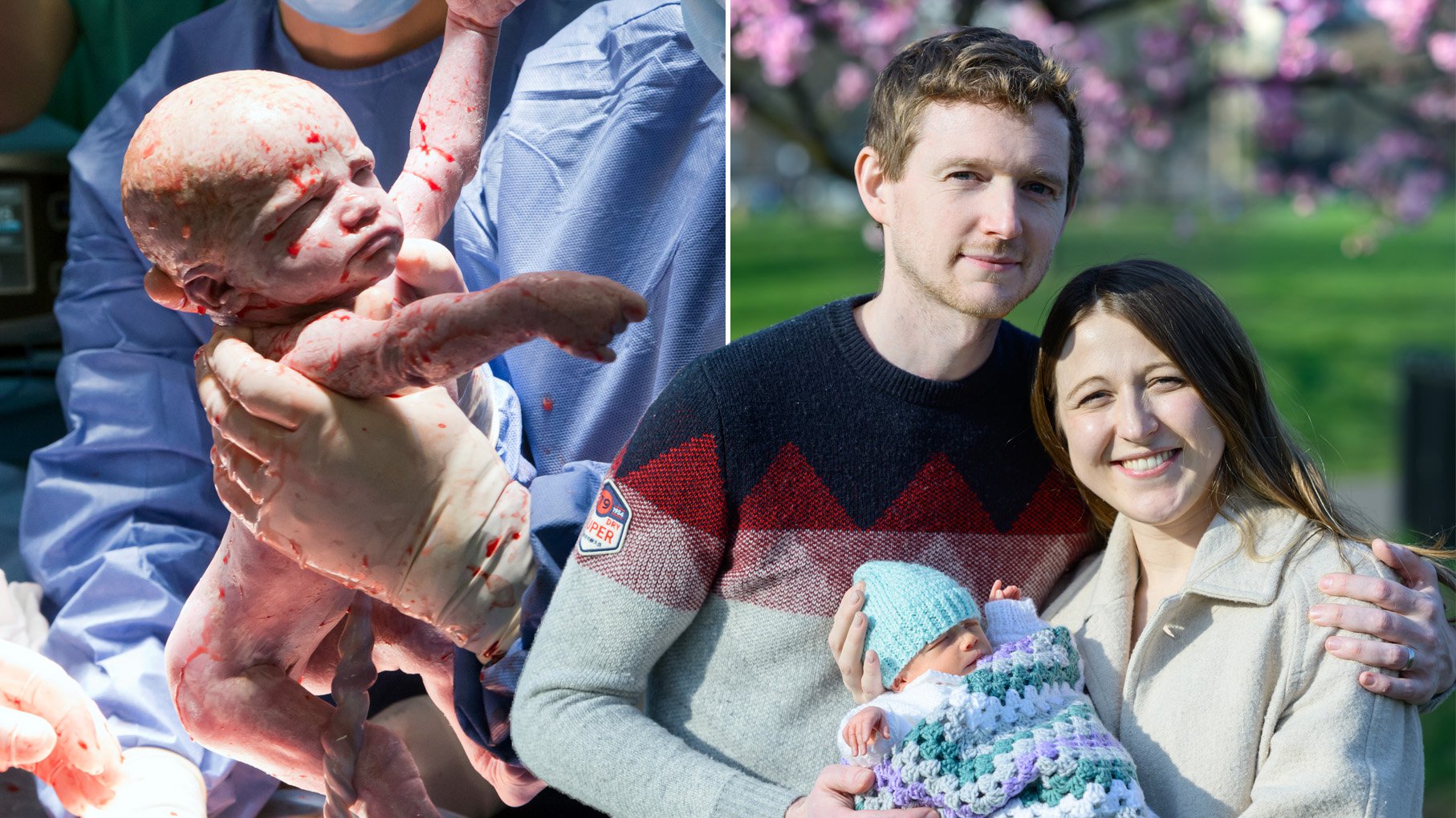 'Miracle' baby born after mum had first ever womb transplant in the UK
