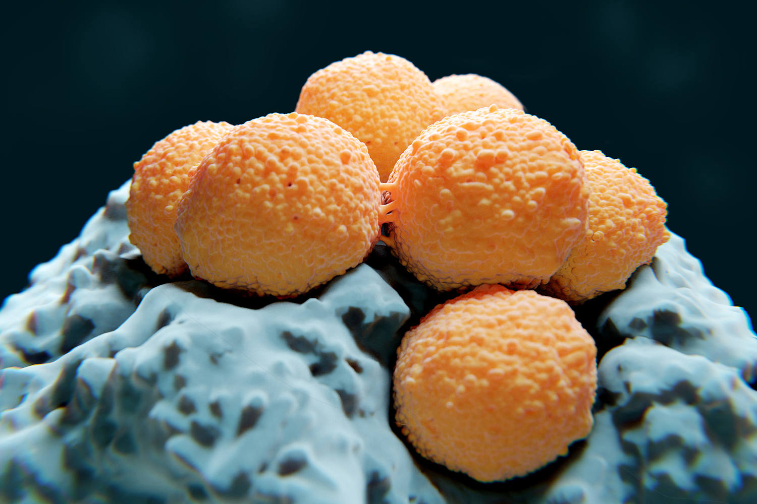 Invasive strep infections have more than doubled in the U.S., CDC study ...