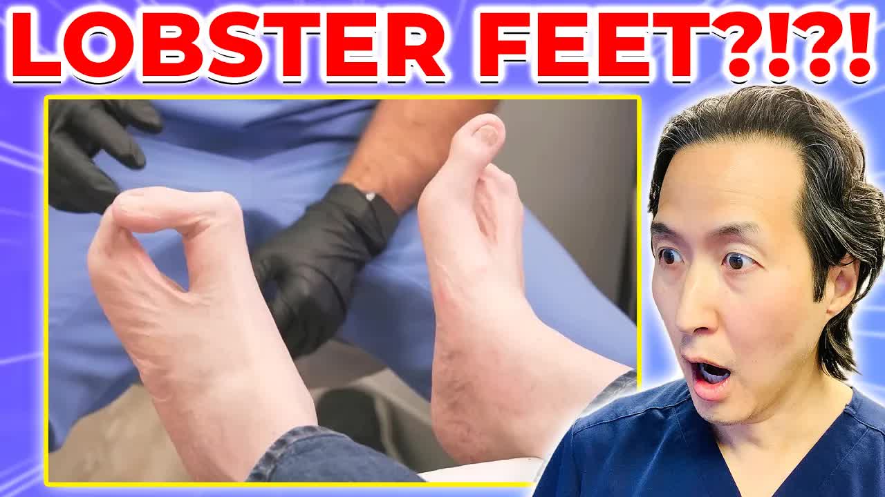 Doctor Reacts to Rare “Lobster Claw” Condition