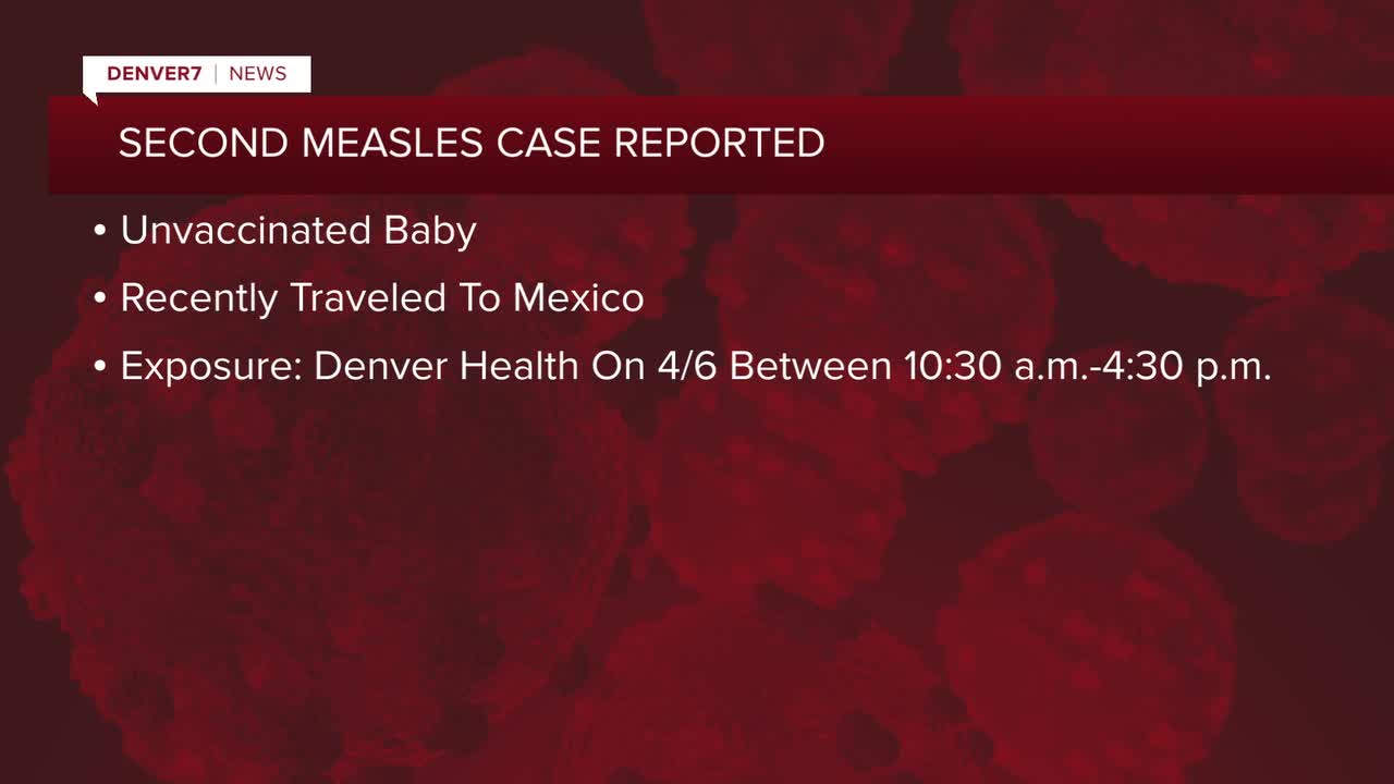 Colorado's second measles case confirmed in unvaccinated Denver County ...