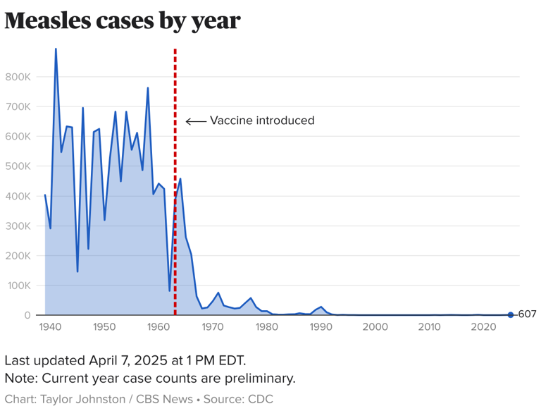 Measles cases in the U.S. break a 33-year record