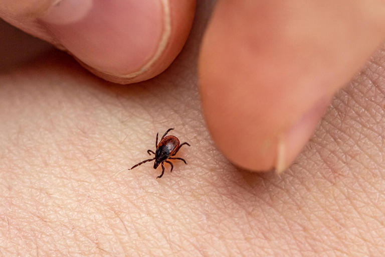 Tick Bite? Here's What to Know About Lyme Disease and Your Next Steps