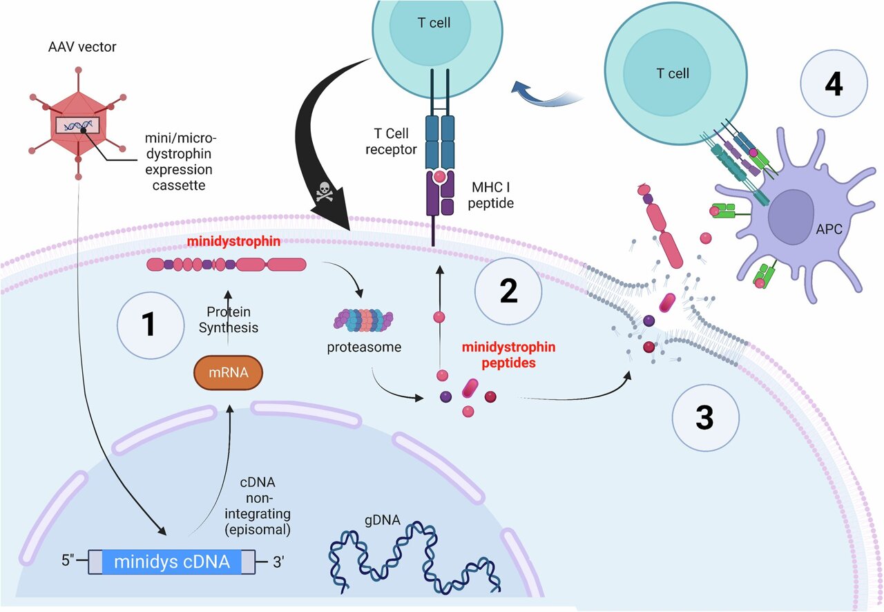 Setback in gene therapy for Duchenne muscular dystrophy as immune ...