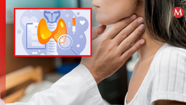 Qué es la tiroiditis de hashimoto y cómo detectar la enfermedad autoinmune