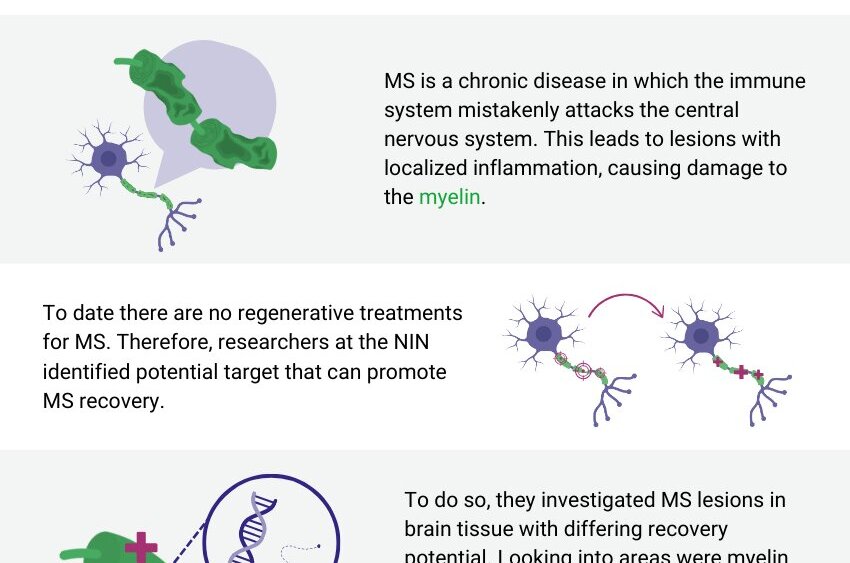 New therapeutic targets discovered for multiple sclerosis tissue recovery