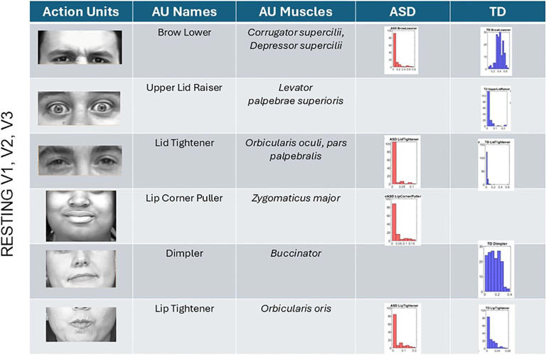 Tracking tiny facial movements can reveal subtle emotions in autistic ...