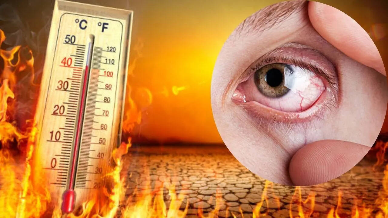 Heatwaves Can Cause Eye Stroke and permanent Blindness; Here's How To ...