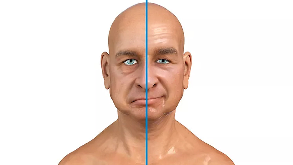 Rapper Lil Nas X Suffers Bell's Palsy, Hospitalised After Suffering ...