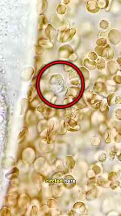 White blood cells ATTACK giant parasite worm!