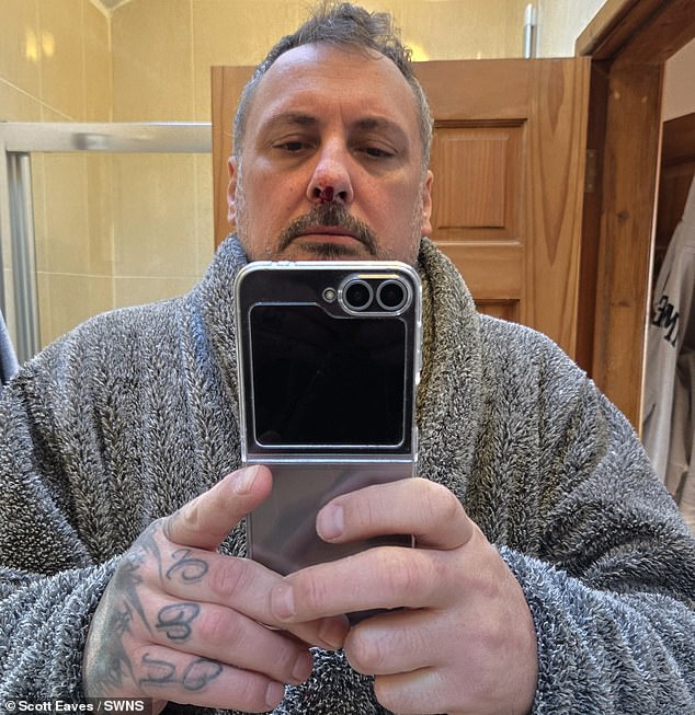 Moment man plunges through decking and breaks his foot