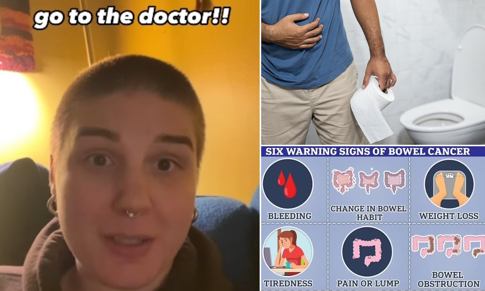 Chance test spotted symptom-less pre-cancer in 25-year-old's colon