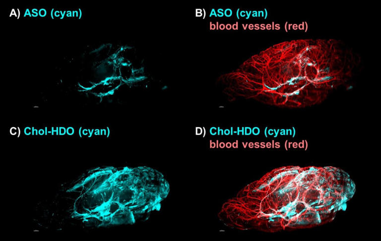 Cholesterol-modified oligonucleotides show promise for treating brain ...