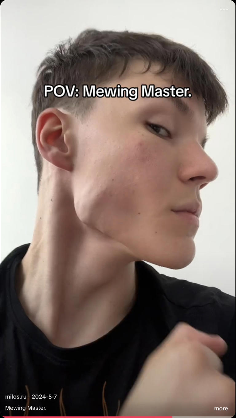 Teen boys are going to extreme lengths to be ‘skinny like Timothée ...