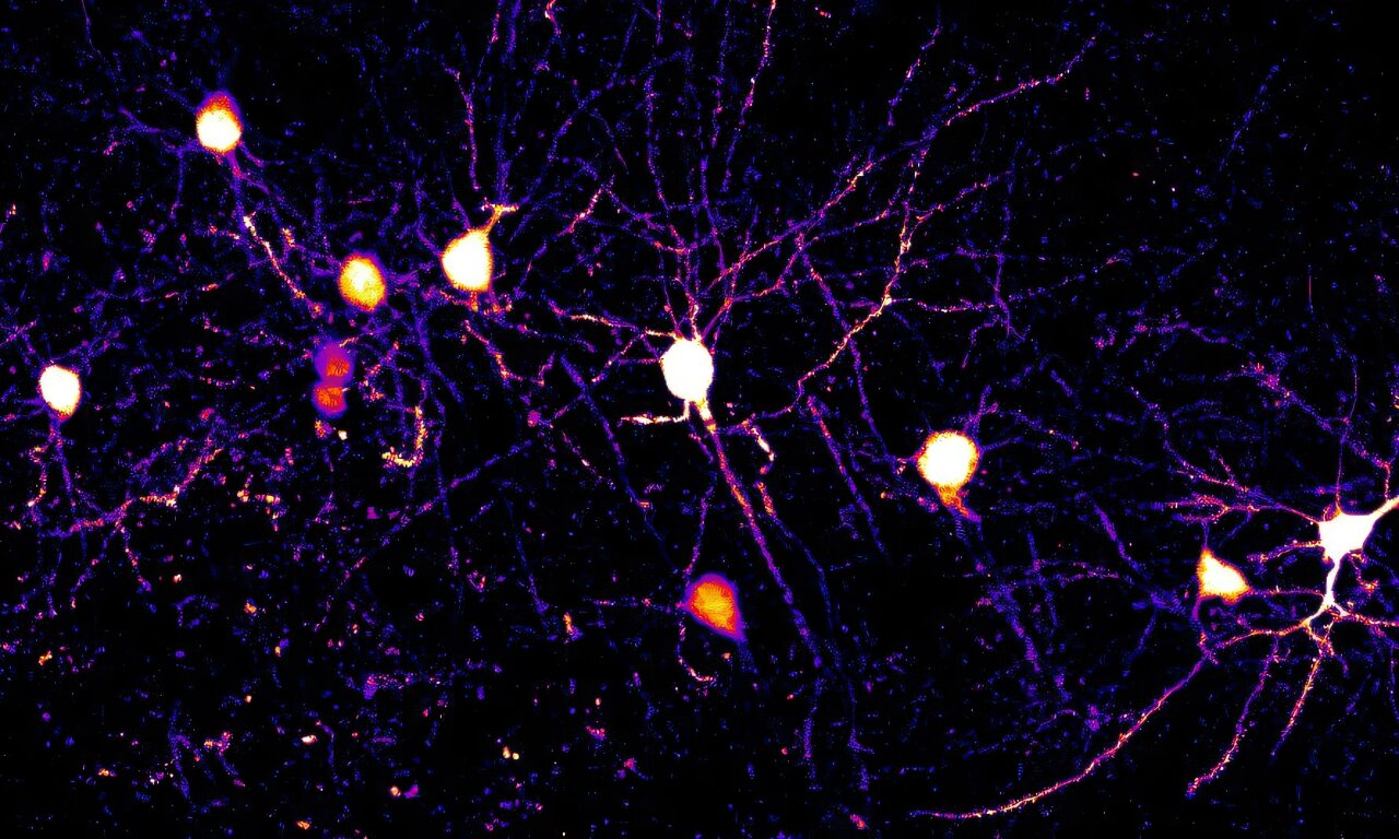 Brain imaging study reveals synaptic mechanisms of learning