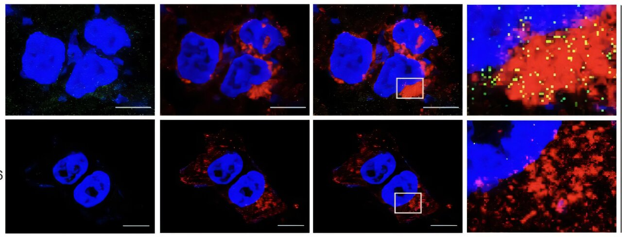 Scientists hack cell entry to supercharge cancer drugs