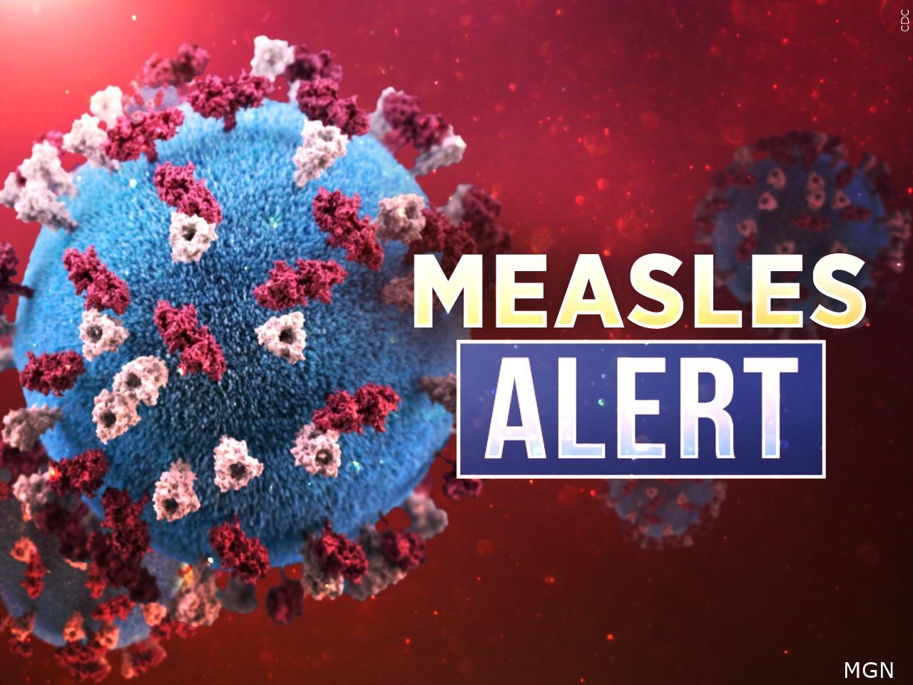 19 cases of measles confirmed in Upshur County location