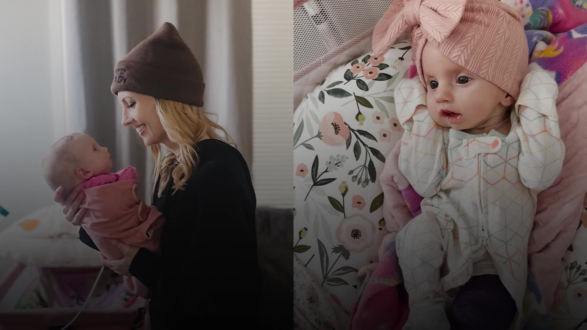 Mum of baby born with eyes wide open due to facial paralysis can sense ...