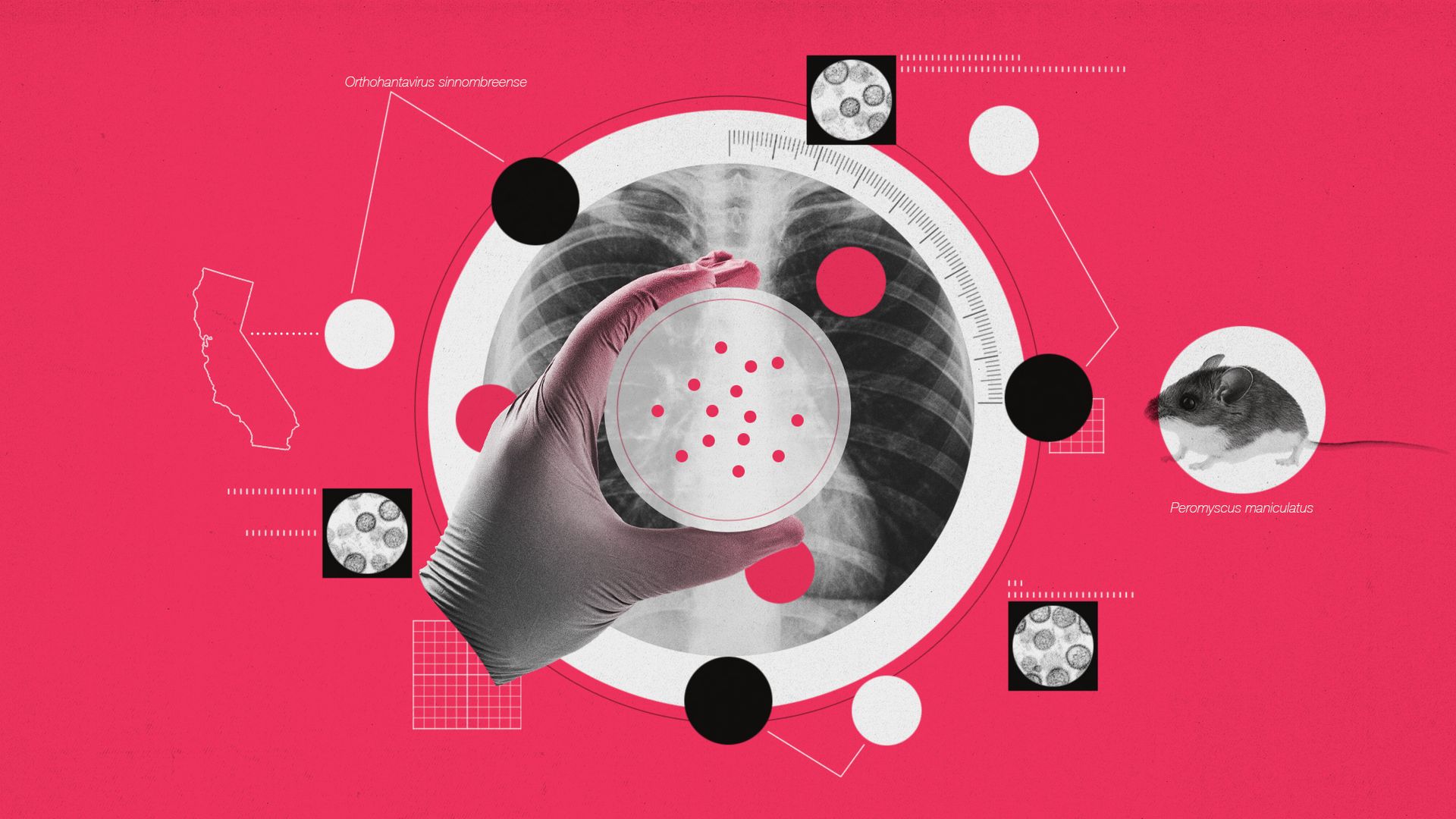 Hantavirus: the rare pathogen linked to rodents that attacks the lungs