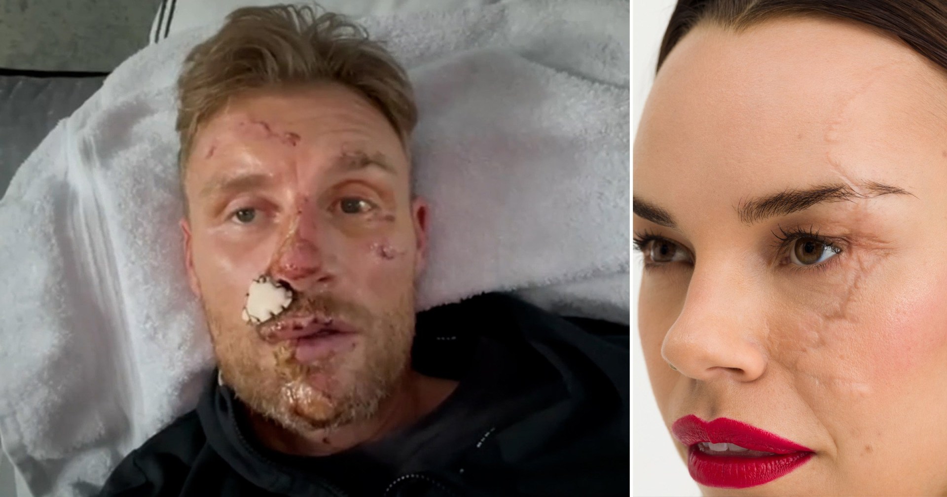 I think Freddie Flintoff’s facial scars look cool – and they’re just ...