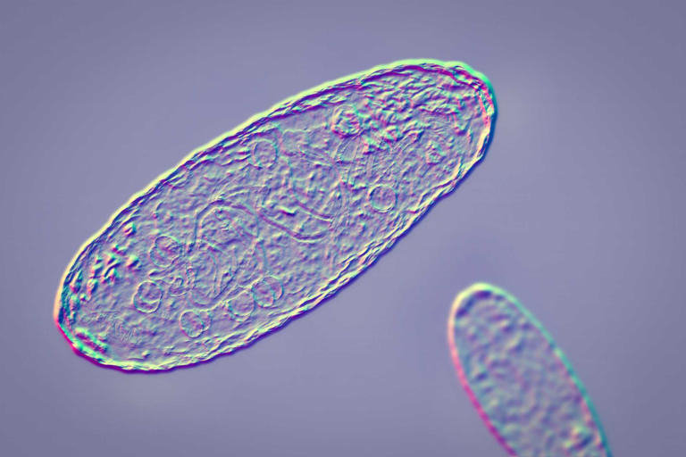 First New Mexico animal plague case in 2025