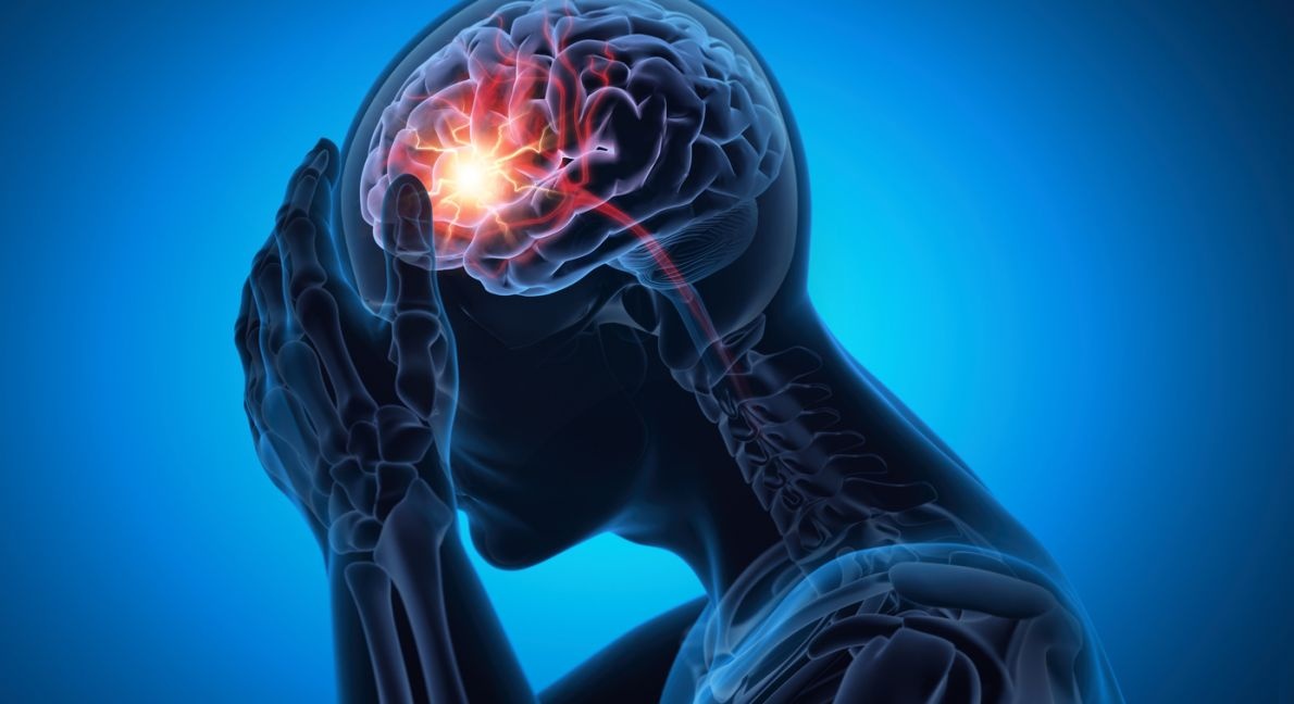 Aprile: mese della prevenzione contro l’ictus cerebrale