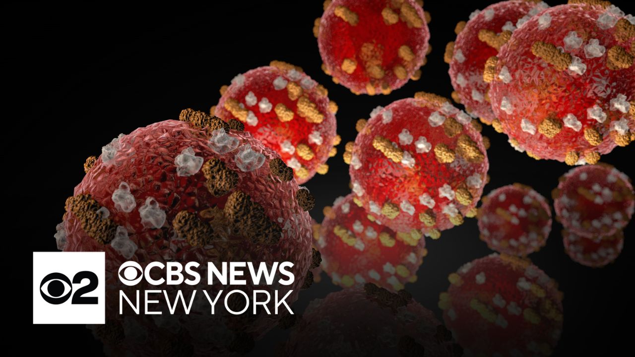 Measles could become endemic in U.S., study finds