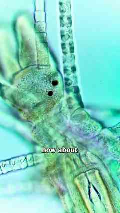 Craziest find in a drop of OCEAN ROCKPOOL WATER under the microscope!