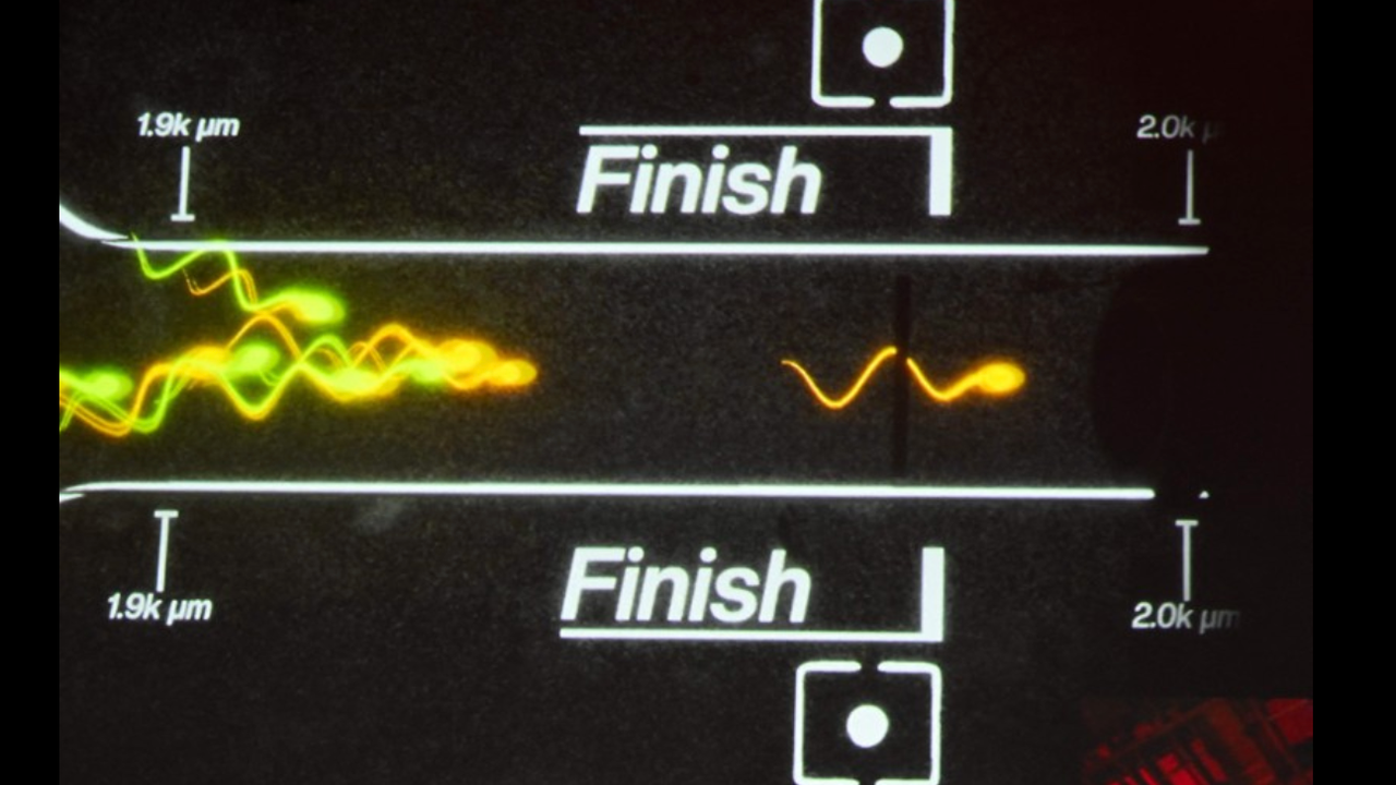 World's first 'Sperm Race' targets male fertility decline: Video