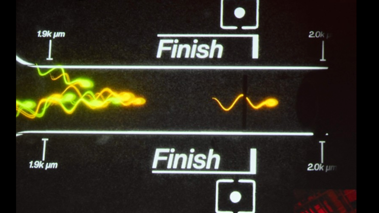 World's first 'Sperm Race' targets male fertility decline: Video