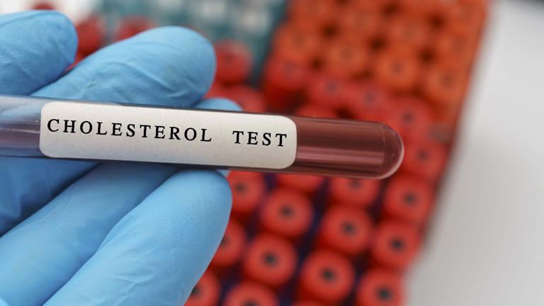 Busting the biggest cholesterol myths and things you should know about ...