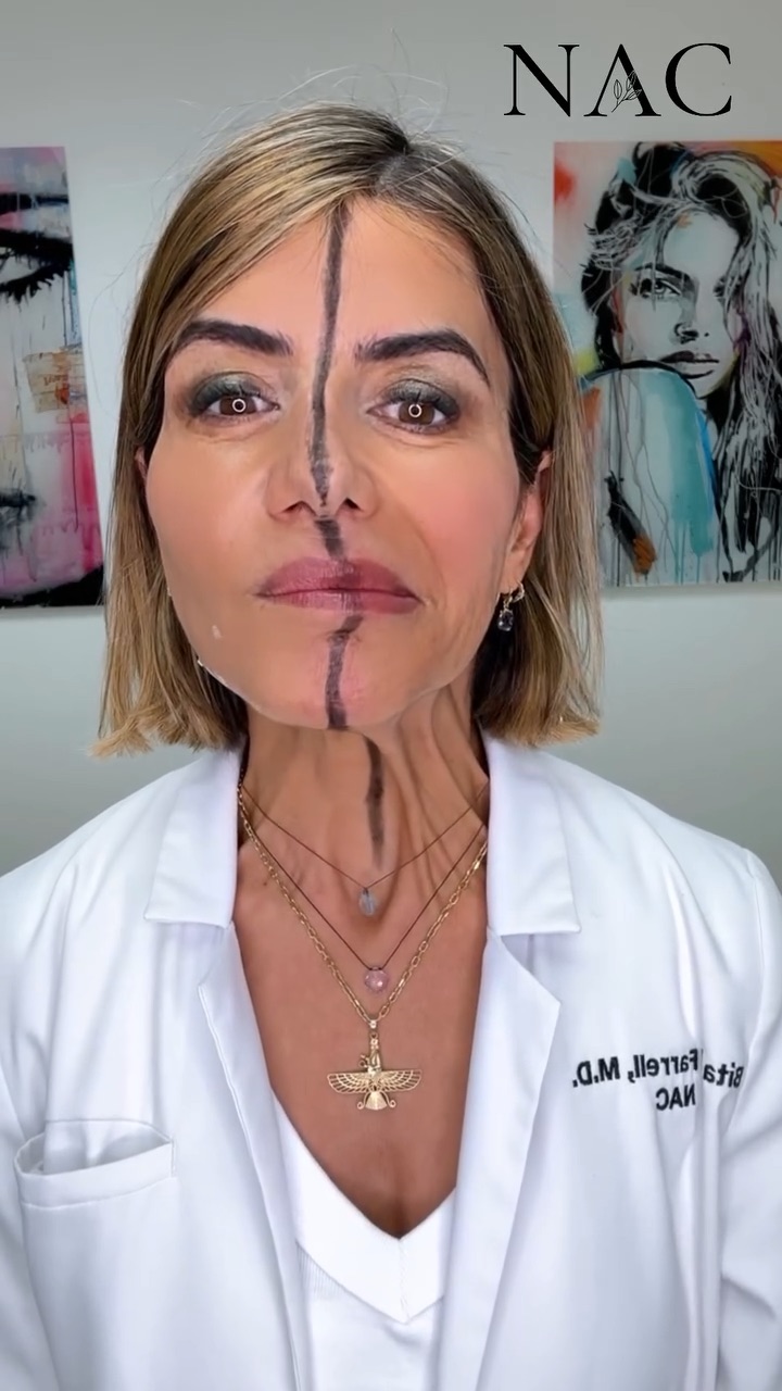 Doctor injects Botox into only one side of her own face — revealing an ...