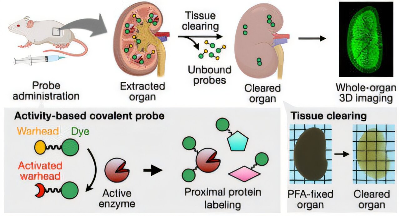 High-resolution 3D imaging reveals enzyme activity differences and drug ...