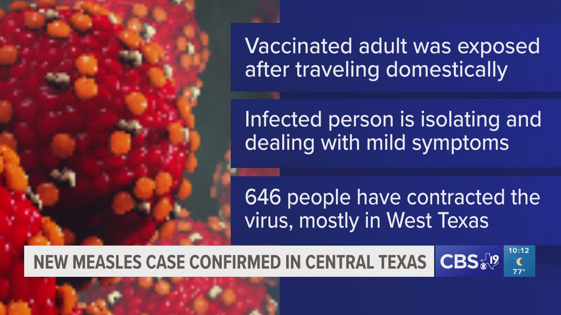 New measles case confirmed in Central Texas