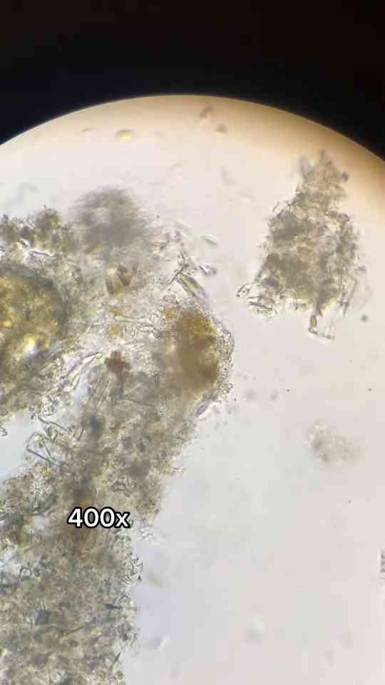 What Does Your Skin Really Look Like Under the Microscope?