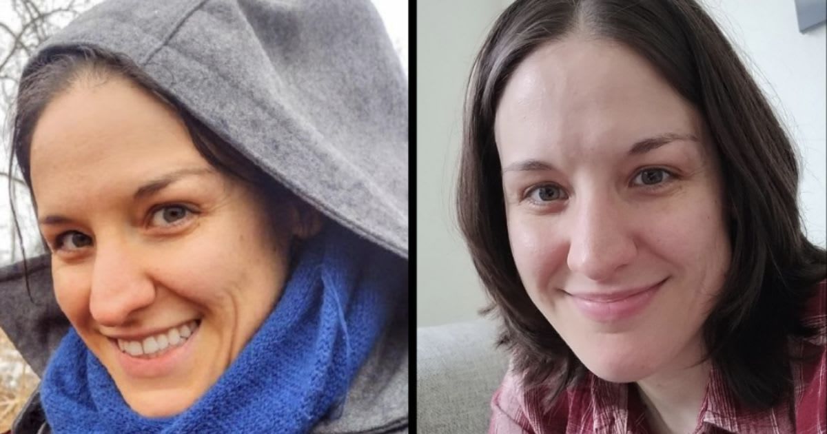 Woman Develops a Skin Condition After Eating Carrots Every Day for ...