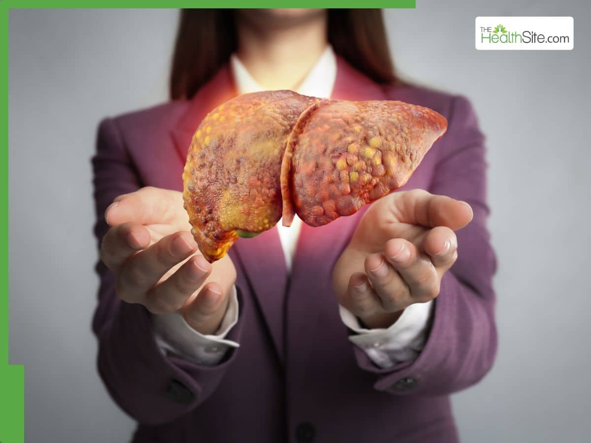 Symptoms Of Terminal Liver Dysfunction: 7 Signs Your Liver Is Dying