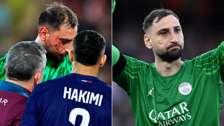 Why does Gianluigi Donnarumma have a scar on his face? Horror injury in ...
