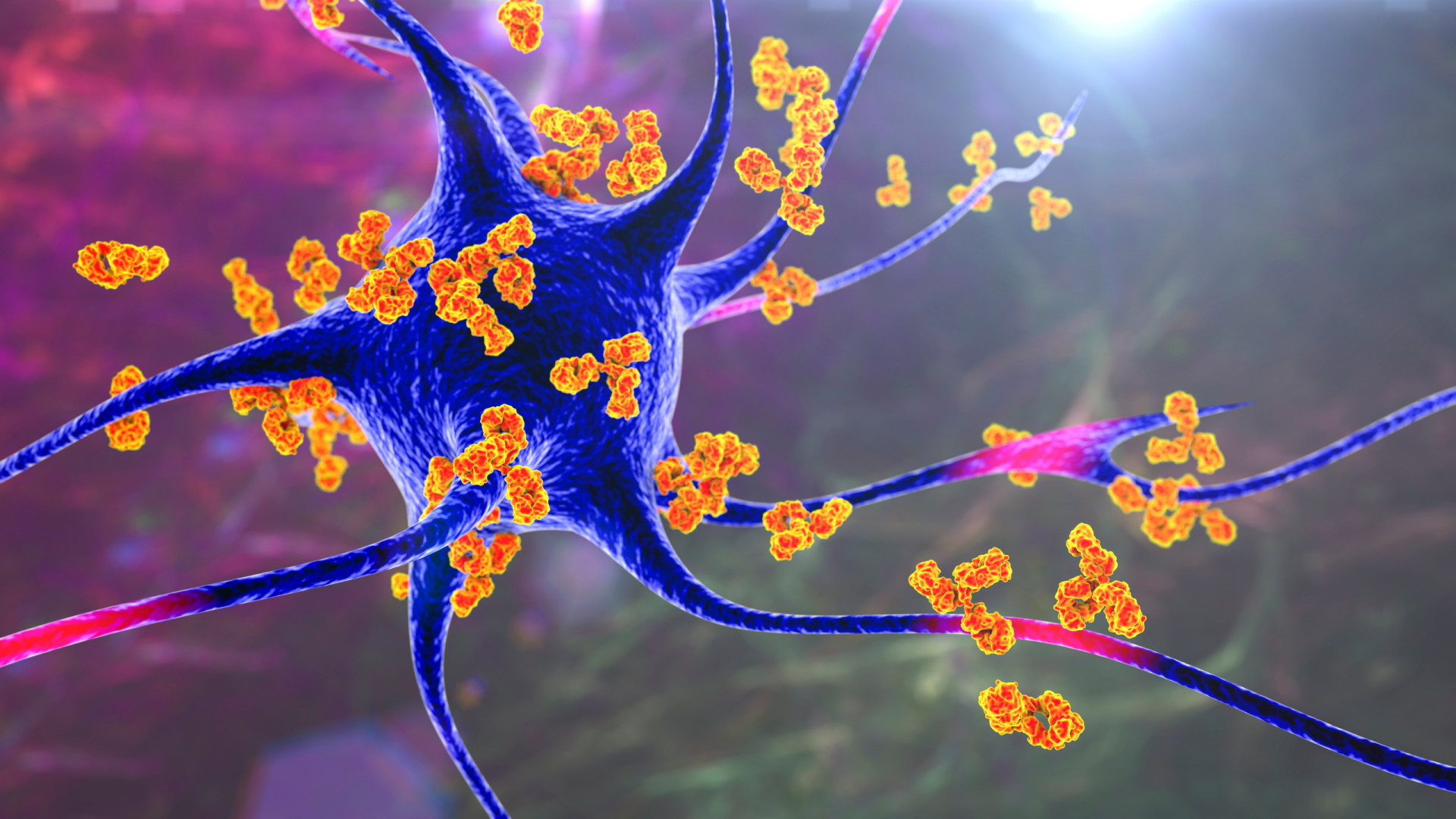 Why are autoimmune diseases increasing?
