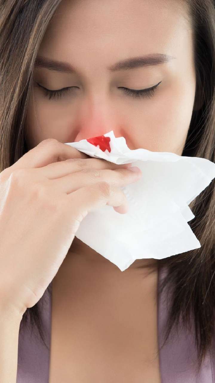 5 Easy Tips To Reduce Nose Bleeding In Summer Season!