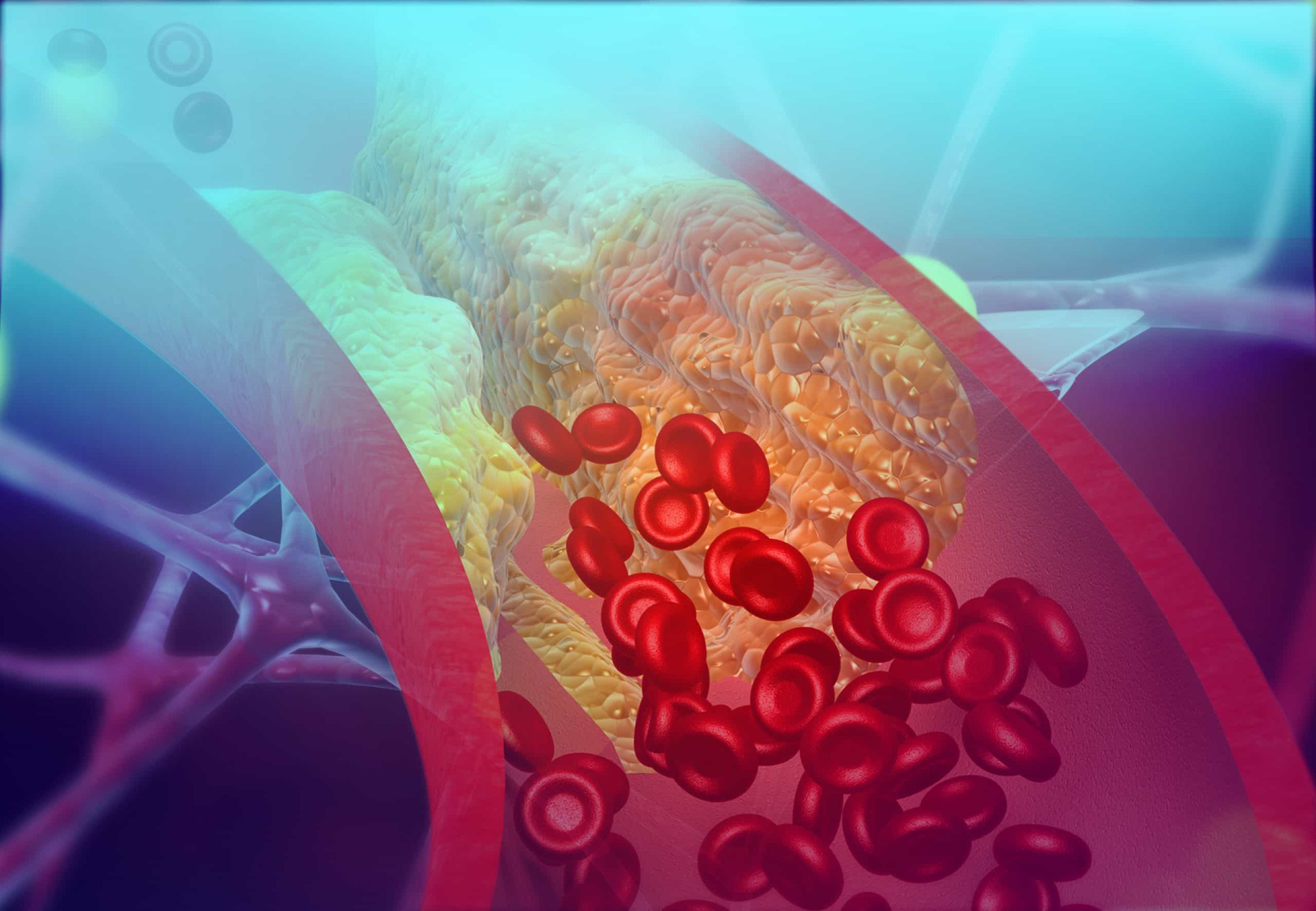 Natural ways to lower your cholesterol