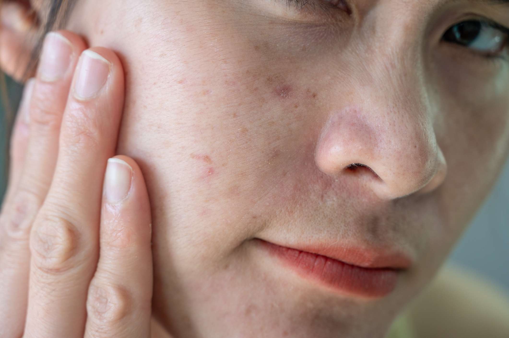 13 dermatologist-approved tips to improve skin texture