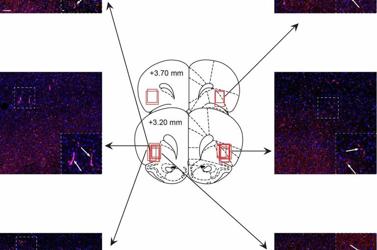 Parallel Activity In Orbitofrontal Cortex And Hippocampus Shapes Cognitive Maps And Schemas