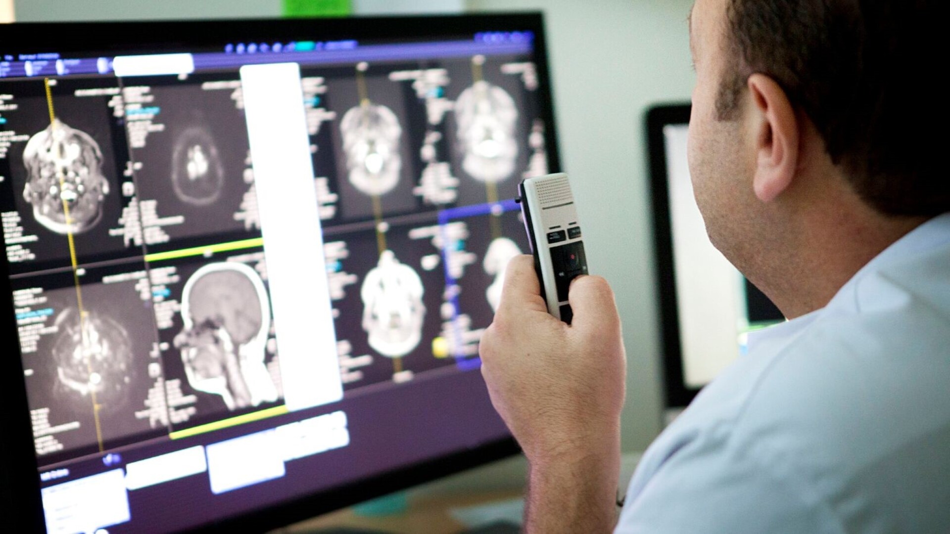 Robots can do ‘amazing’ work in the medical field