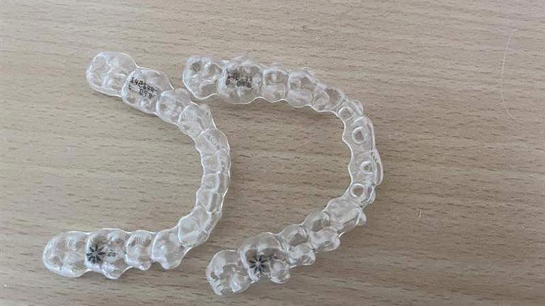 Invisalign review: How I got the smile I’ve always wanted