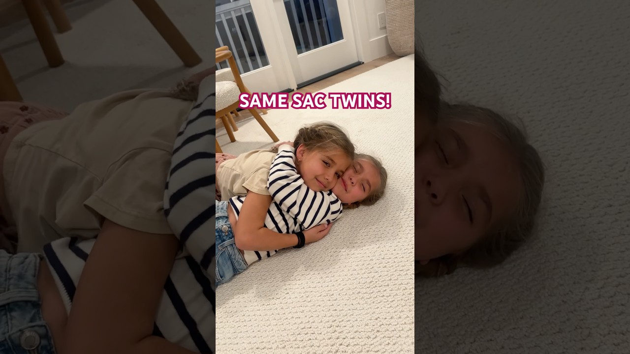 Unbreakable Duo: The Inseparable Twins' Story