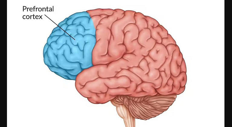 Study relates damage in 'medial' region of prefrontal cortex to impulsivity