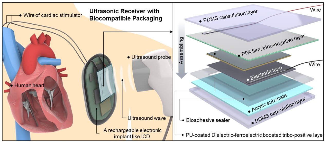 Flexible biocompatible ultrasonic receiver enables efficient wireless ...